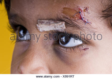 plaster, accident, hurt, injury, cut, bruise, bump, squeeze, head Stock ...
