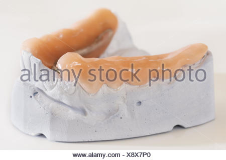 dental impression, adjusted bite splint, Michigan splint, medium Stock ...