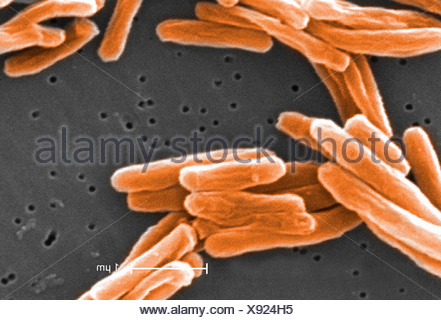 Scanning electron micrograph of Mycobacterium tuberculosis bacteria ...