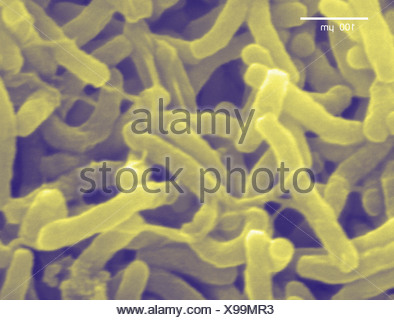 Scanning electron micrograph (SEM) of Vibrio cholerae bacteria, This ...