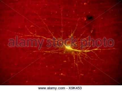 Nerve fibres. Light micrograph (LM) of a transverse section through a ...