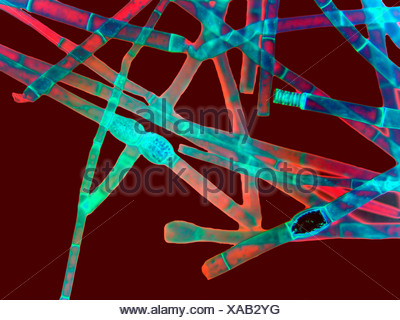 Microscopic view filamentous algae Oedogonium showing oogonium Stock ...
