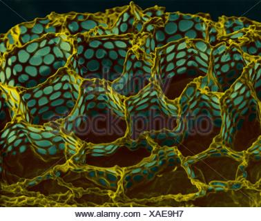 This scanning electron micrograph (SEM) shows the mucosal surface of ...
