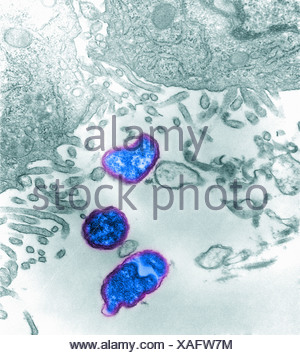 Orientia tsutsugamushi rickettsia, TEM Stock Photo - Alamy