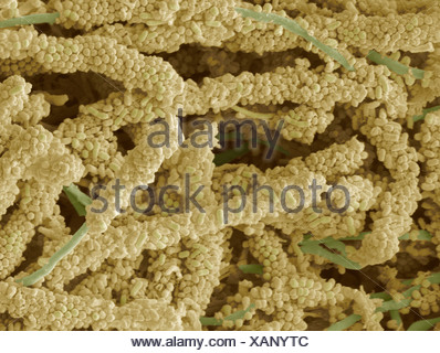 Plaque-forming bacteria, coloured scanningelectron micrograph (SEM ...