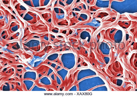 Scanning electron micrograph of Borrelia burgdorferi spirochete ...