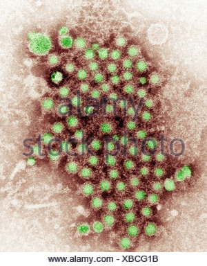 Hepatitis-B Virus, EM Stock Photo: 135012019 - Alamy