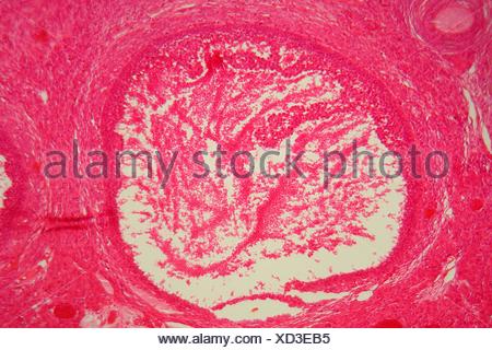 Ovary tissue under the microscope Stock Photo: 93555447 - Alamy