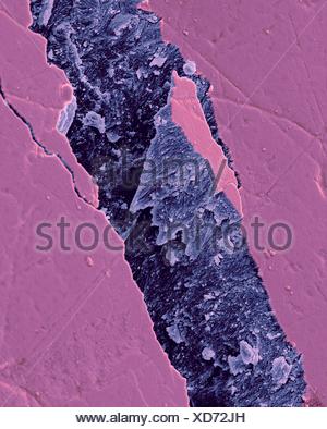 Tooth enamel. Coloured scanning electron micrograph (SEM) of a section ...