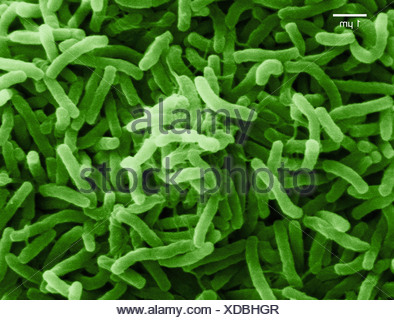 Scanning electron micrograph (SEM) of Vibrio cholerae bacteria, This ...