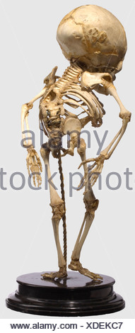 A German skeleton prepared for pathological or anatomical Stock Photo ...