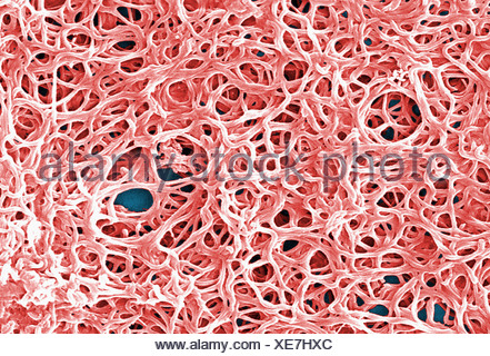 Lyme Disease, Borrelia burgdorferi Bacteria, SEM Stock Photo: 135023173 ...