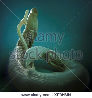 Schistosomiasis also known as snail fever is parasitic disease caused ...