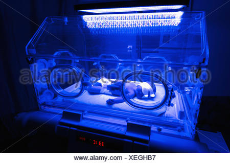 Newborn baby in an incubator with blue light for jaundice in the Stock ...