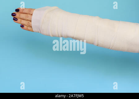 Die gebrochene Hand und der Gips im Krankenhaus mit dem Daumen nach ...