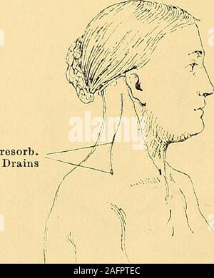 . Anleitung zur Technik der antiseptischen Wundbehandlung und des ...