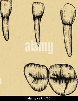 Auf Extraktion, mit Notizen auf der Anatomie und Physiologie, der Zähne ...