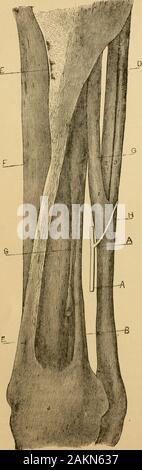 . Abb. 12.- Der flexor Perforatus und Flexor Perforans sehnen. Das ...