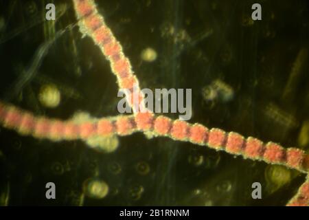 Mikro, Mikroskop, Instrument, Mikroskopie, Wissenschaft, Untersuchen ...
