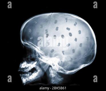 Röntgenaufnahme des menschlichen Schädels, Seitenansicht. Medizinische ...