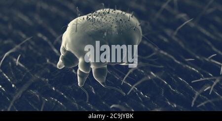 Abbildung einer scabies mite auf die menschliche Haut Stockfotografie ...