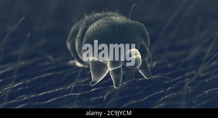 Abbildung einer scabies mite auf die menschliche Haut Stockfotografie ...
