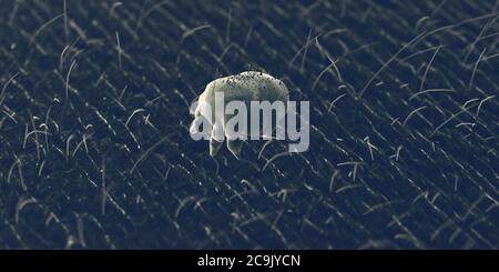 Abbildung einer scabies mite auf die menschliche Haut Stockfotografie ...