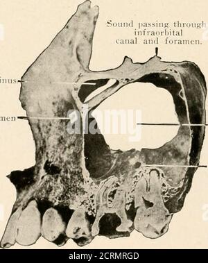Zahnmedizinische Anatomie - Erste Oberkiefer Backenzahn. Medizinisch ...