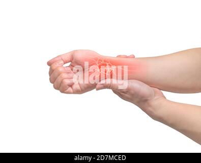 X-Ray von Menschenhand mit gebrochenen Handgelenk, Fraktur des Radius ...