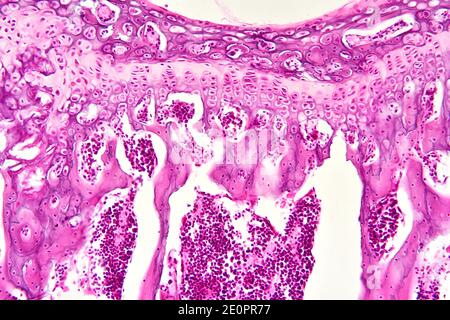 Menschliches rotes Knochenmark, hämatopoetisches Gewebe. X 75 bei 10 cm ...
