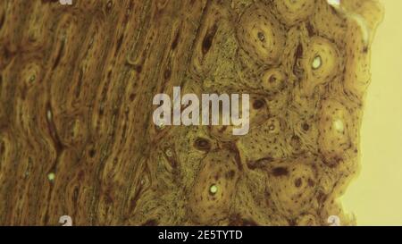 Querschnitt des menschlichen Röhrenknochen zeigt Trabekel Knochengewebe ...