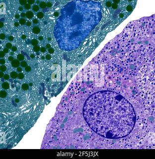 Pankreas Zelle. Farbige Scanning Electron Micrograph (SEM) eines Acinar ...
