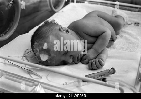 Die siamesischen Zwillinge Anna und Barbara Rozycki, die im ...