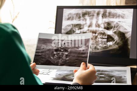 Panorama-Röntgenaufnahme der Kinderzähne von zwei Kiefers ...