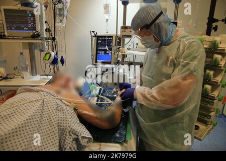 Eine Krankenschwester überwacht das Gerät. Alle Patienten mit Covid-19 ...