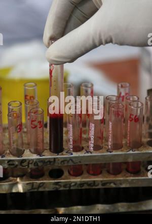 Blood samples collected from patients, suspected to be suffering from ...