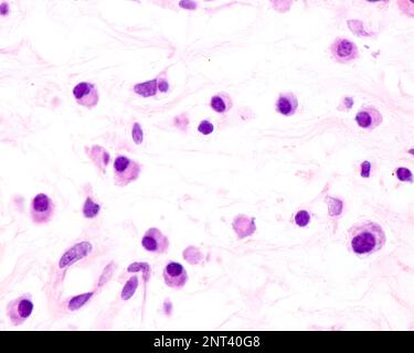 Plasmazellen sind B-Lymphozyten, die durch die Anwesenheit von ...