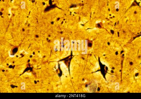 Lichtmikrographische Darstellung einer menschlichen Hirnrinde mit ...