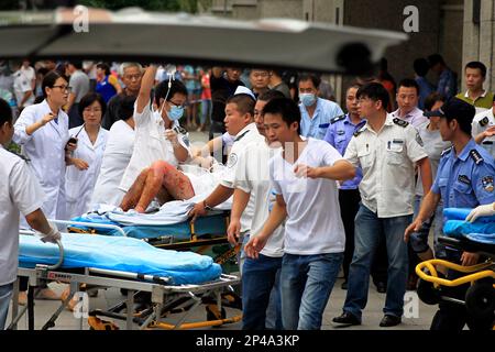Medical staff move a severely burnt victim of an explosion at an ...