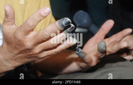 Double amputee mountaineer Gary Inglis smiles as he arrives at ...