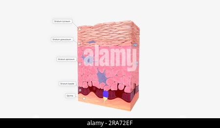 Die Epidermis ist die äußerste Hautschicht und besteht hauptsächlich aus Keratinozytenzellen ...