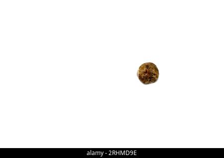 Große Gallensteine, die nach laparoskopischer Cholezystektomie ...