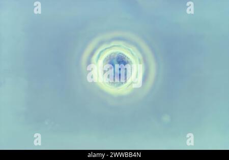 Mit Phasenkontrast-Bildgebung und 1125-facher Vergrößerung zeigt dieser ...