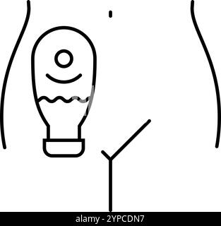 Stomachirurgie-Liniensymbol-Vektor. Ostomie-Operationszeichen. Schwarze ...