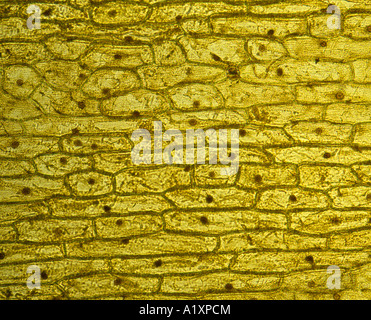 ZWIEBEL-HAUTZELLEN (EPIDERMISZELLEN) / ZEIGT ZELLSTRUKTUR UND KERN ...