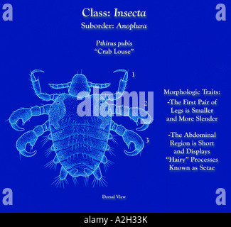 Filzlaus, Krabbe, pubic Laus (Pthirus Pubis, Phthirus Pubis ...