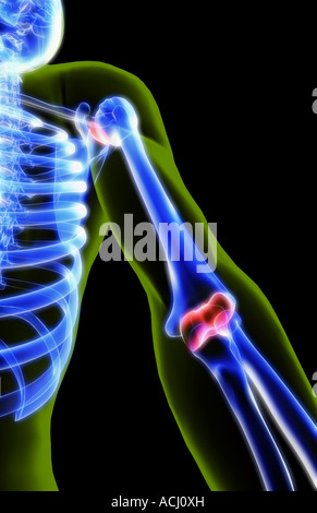 Gelenke der oberen Extremität Stockfotografie - Alamy