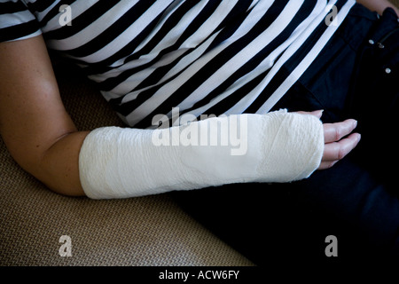 EINE GEBROCHENEN RECHTEN ARM COLLES FRAKTUR GESETZT IN GIPS AUS DER ...