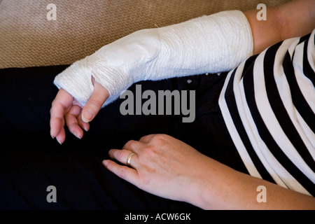 EINE GEBROCHENEN RECHTEN ARM COLLES FRAKTUR GESETZT IN GIPS AUS DER ...