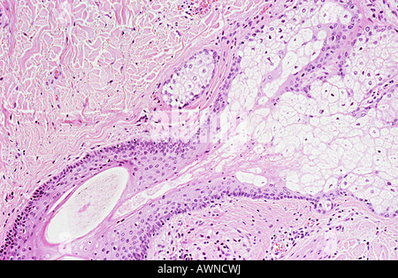 Menschliche Hautzellen Haut Anatomie Stockfoto, Bild: 75039798 - Alamy